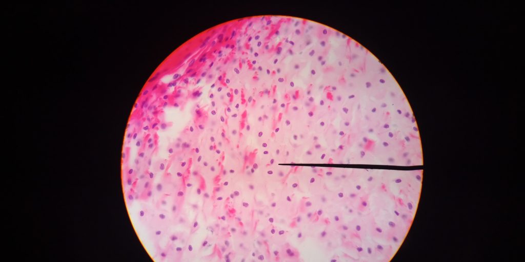 Dense Regular Connective Tissue Anatomy